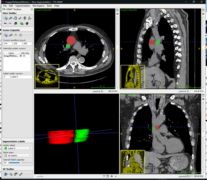 ITK-snap医学图像标注方法（超级详细）——保姆级_学习_Curb-GitCode 开源社区