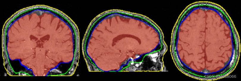 脑分析工具使用说明汇总_qsiprep教程-CSDN博客