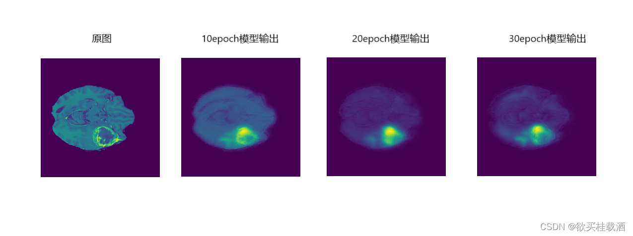 Tensorflow2.6实现Unet结构神经网络（3D卷积）识别脑部肿瘤并实现模型并行_unet segmentation with tensorflow-CSDN博客
