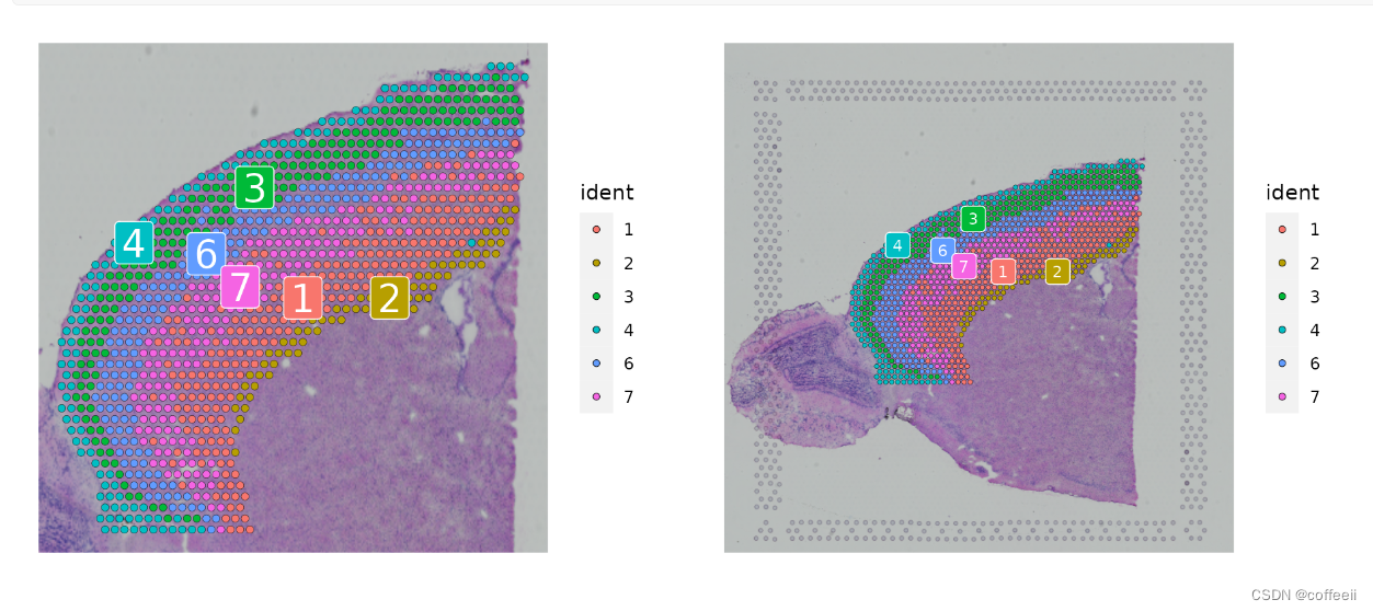跟着Seurat官网学空间转录组（10X数据集为例，包含细胞映射，无监督学习）_seurat空间转录组-CSDN博客