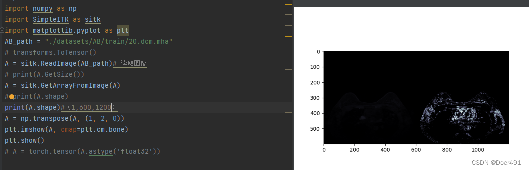 pix2pix处理dicom数据集_.pix格式的dem数据·-CSDN博客