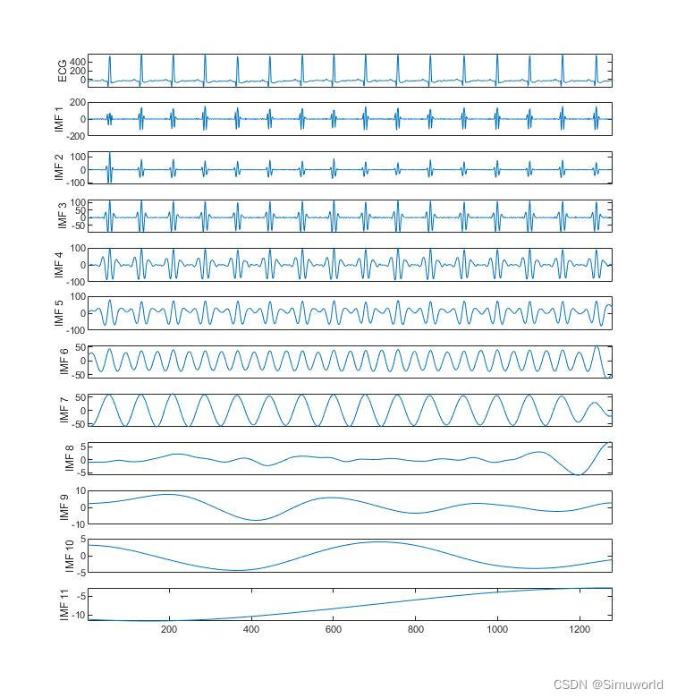 ECG信号的EMD分解与特征提取matlab仿真_emg信号特征提取features=frequency features ...
