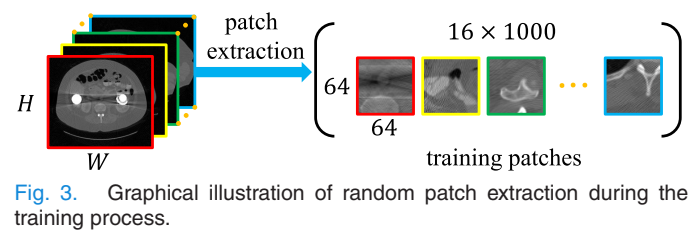 Deep Interpretable Convolutional Dictionary Network for Metal Artifact Reduction in CT Images_卷积 ...