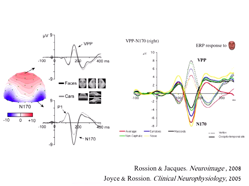 脑电实验设计的原理与实例-EEG Processing and Feature 4-CSDN博客