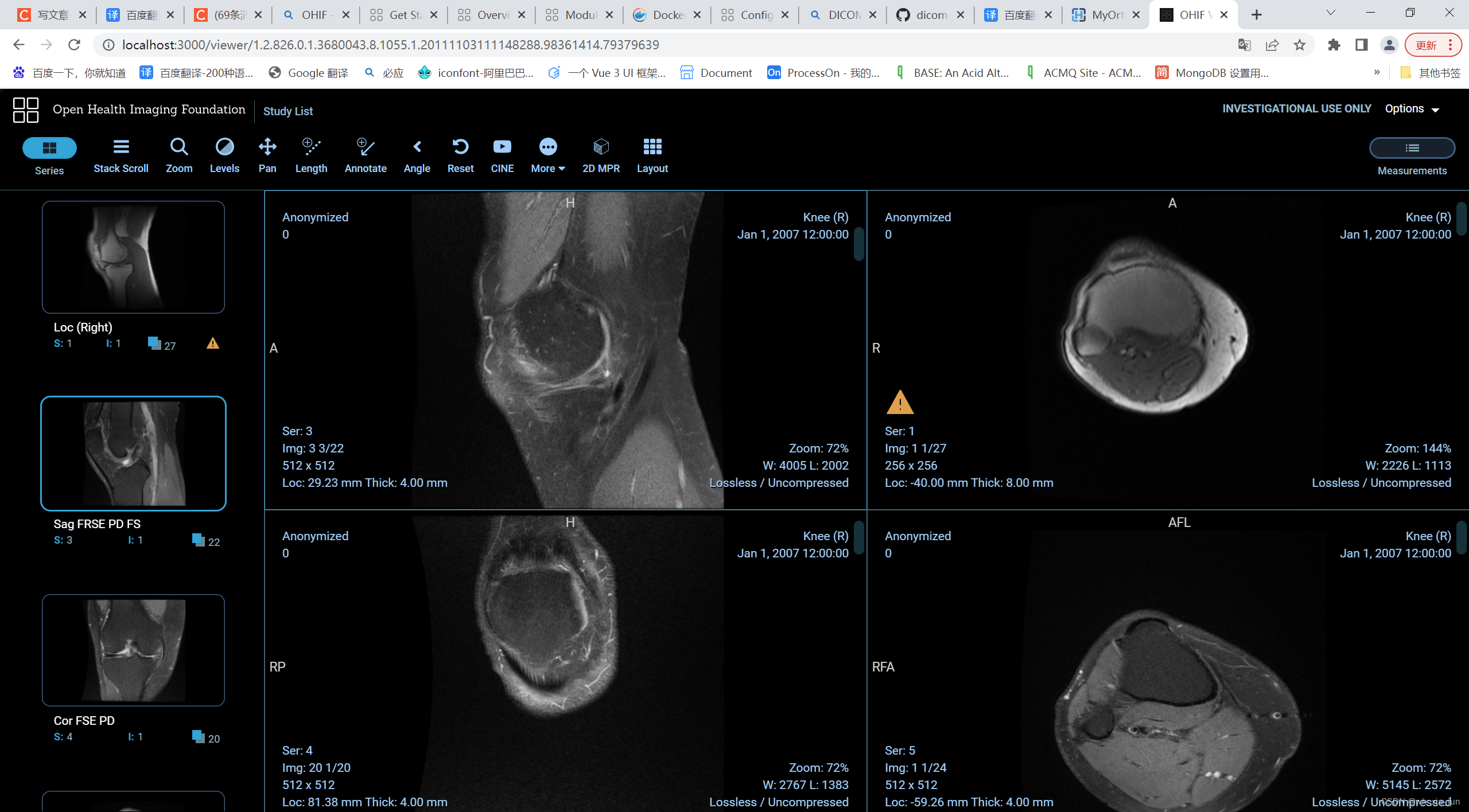 搭建DICOM医学影像系统(OHIF+Orthanc+Nginx)-CSDN博客