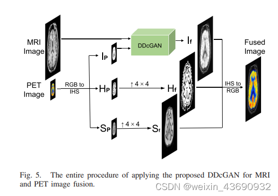 Ddcgan用于多分辨率图像融合的双判别器条件生成对抗网络a Dual Discriminator Conditional Generative Advers Csdn博客 6613