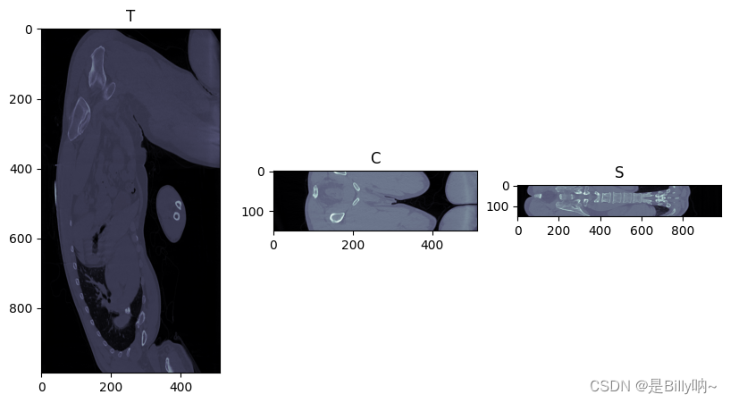 【SimpleITK】CT数据的3D space归一化_3d数据归一化处理-CSDN博客