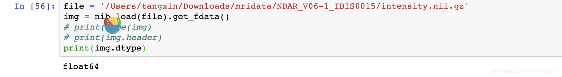 MRI预处理-去颅骨_python ct图像颅骨去除-CSDN博客