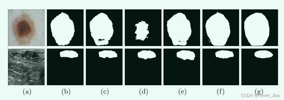 UNeXt: MLP-based Rapid Medical Image Segmentation Network-CSDN博客