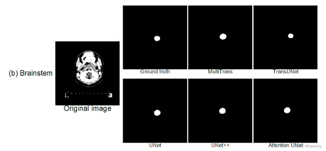 论文笔记MultiTrans: Multi-scale feature fusion transformer with transfer learning strategy_多尺度特征融合模块 ...
