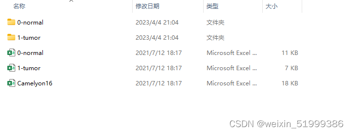 DSMIL论文代码复现，Dual-stream Multiple Instance Learning Network for Whole Slide Image Classification ...