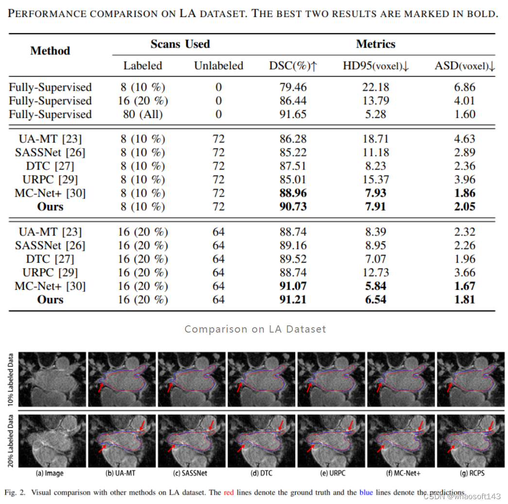RCPS ~医学图像半监督分割_rcps: rectified contrastive pseudo supervision for-CSDN博客