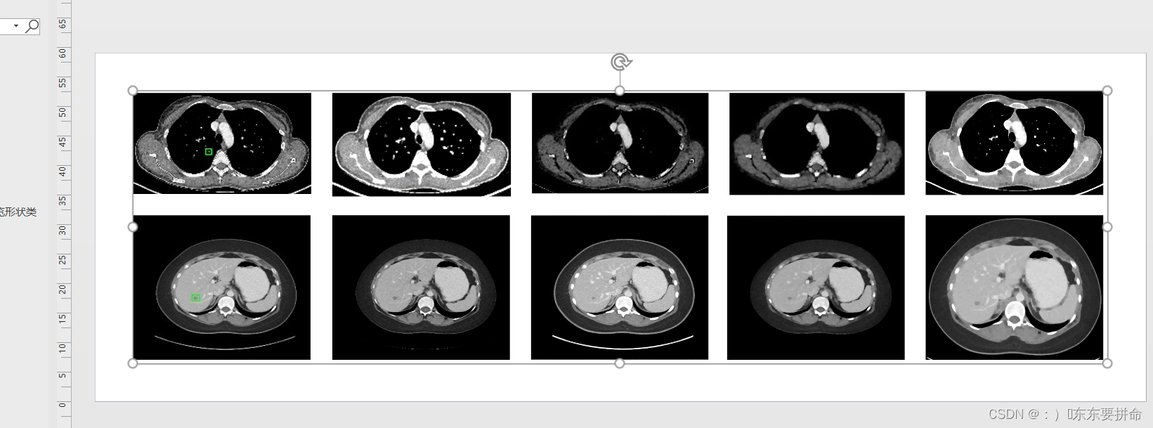 1.overleaf如何插入图片 2.如何制作高清pdf-CSDN博客