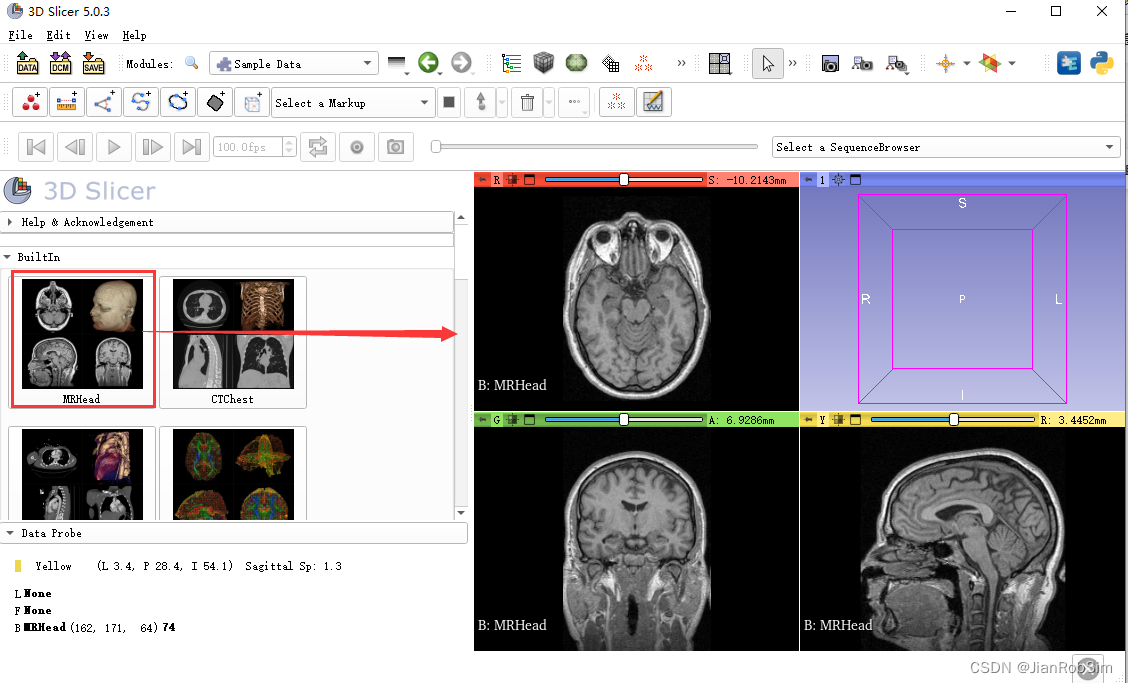 3d Slicer学习记录(1) Igt >volumereslicedriver与图像交互3d Slicer 指定探头位置 Csdn博客