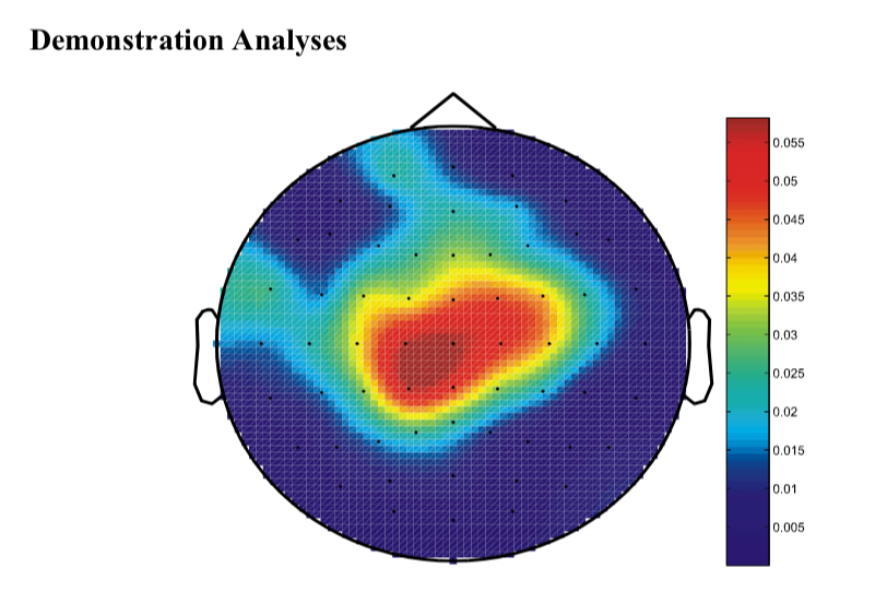 BCI | BCI Competition III：Wadsworth BCI Dataset简介-CSDN博客