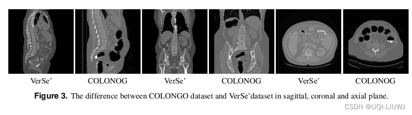 论文笔记：CTSpine1K: A Large-Scale Dataset for Spinal Vertebrae Segmentation ...