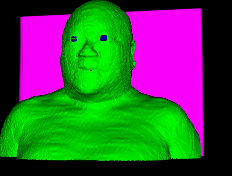 VTK加载DICOM图像并加载RTSTRUCT文件的ContourData_vtk dicom-CSDN博客