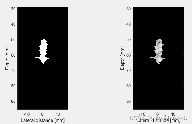 使用Field_II_ver_3_24_windows_gcc工具箱实现超声波数据成像matlab仿真_python fieldii 库-CSDN博客