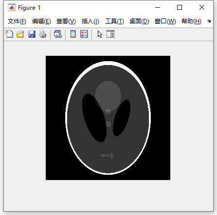 平行束投影数据的仿真（matlab）_matlab phantom函数-CSDN博客