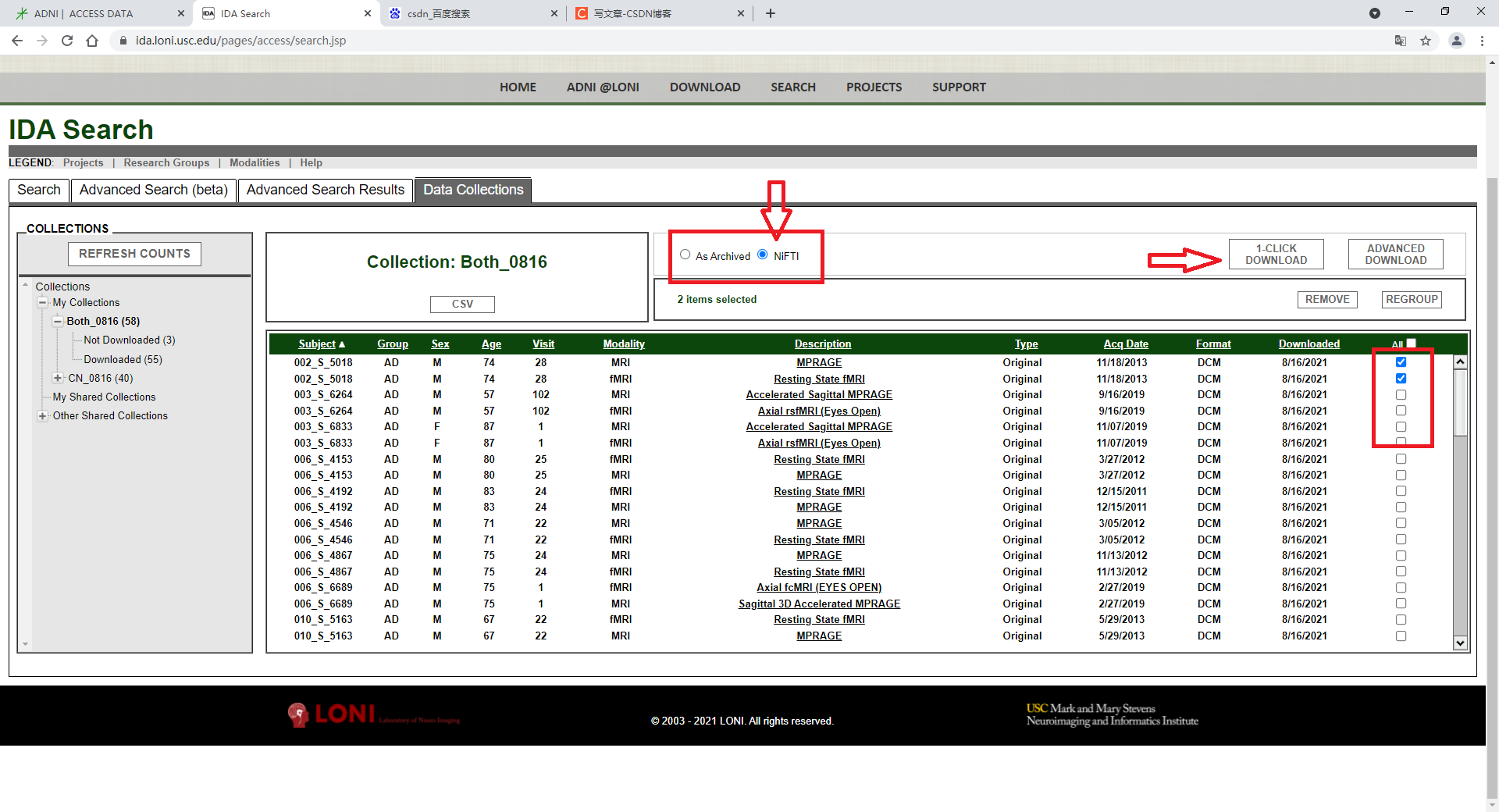 ADNI数据集下载方法（完全步骤）-CSDN博客