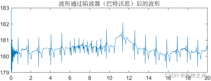 【心电信号 】ECG心电信号QRS波群特征提取【含Matlab源码 3385期】_差分法提取qrs波-CSDN博客