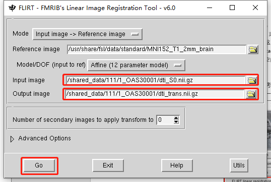 DTI预处理及概率性纤维束追踪_概率性纤维追踪-CSDN博客