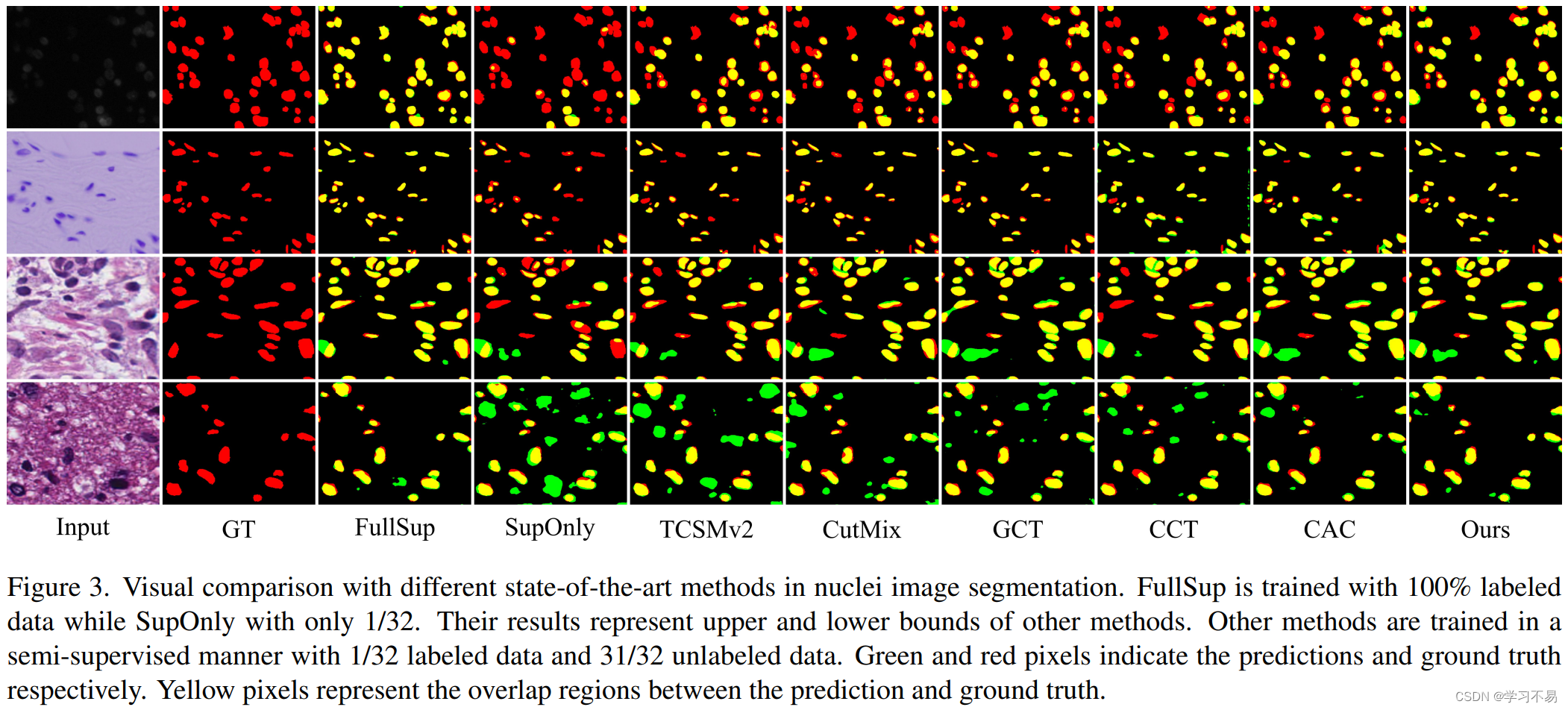 CVPR2022 Cross-patch Dense Contrastive Learning for Semi-supervised Segmentation...-CSDN博客