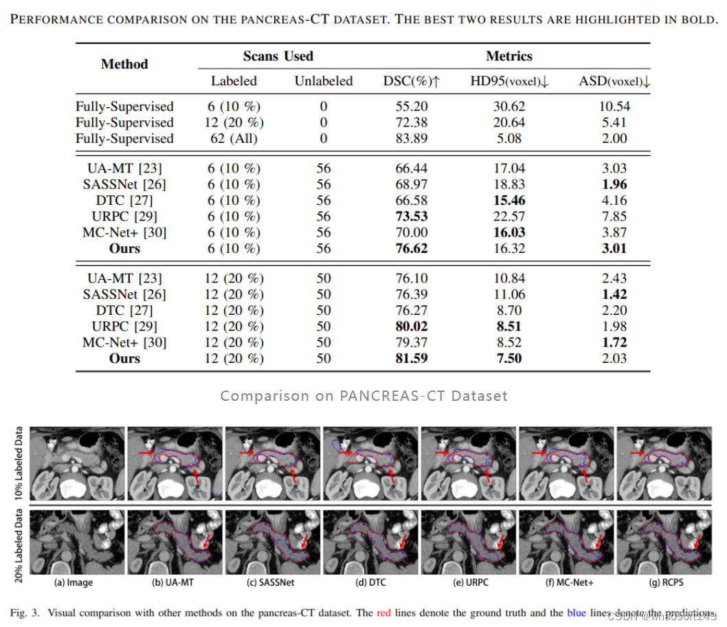 RCPS ~医学图像半监督分割_rcps: rectified contrastive pseudo supervision for-CSDN博客