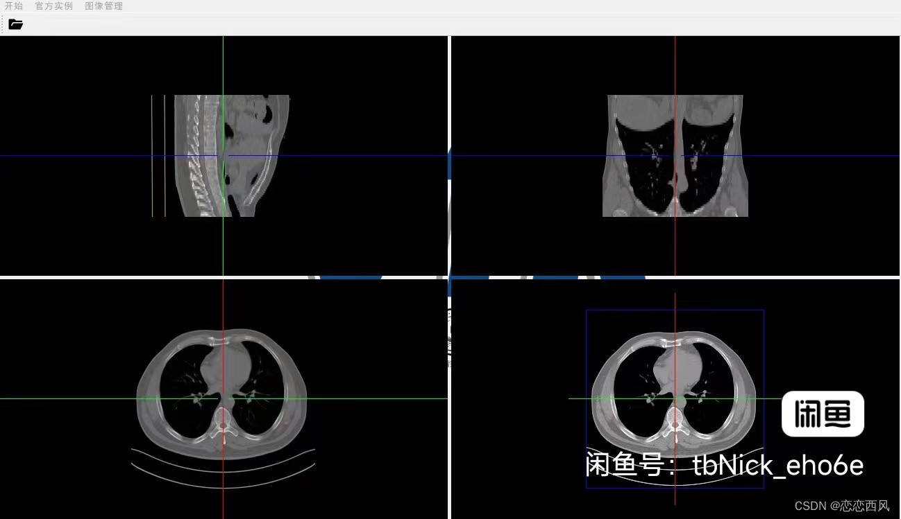 Vtk Mpr 三维重建(一) 多层面重建 四视图vtk多平面重建 Csdn博客