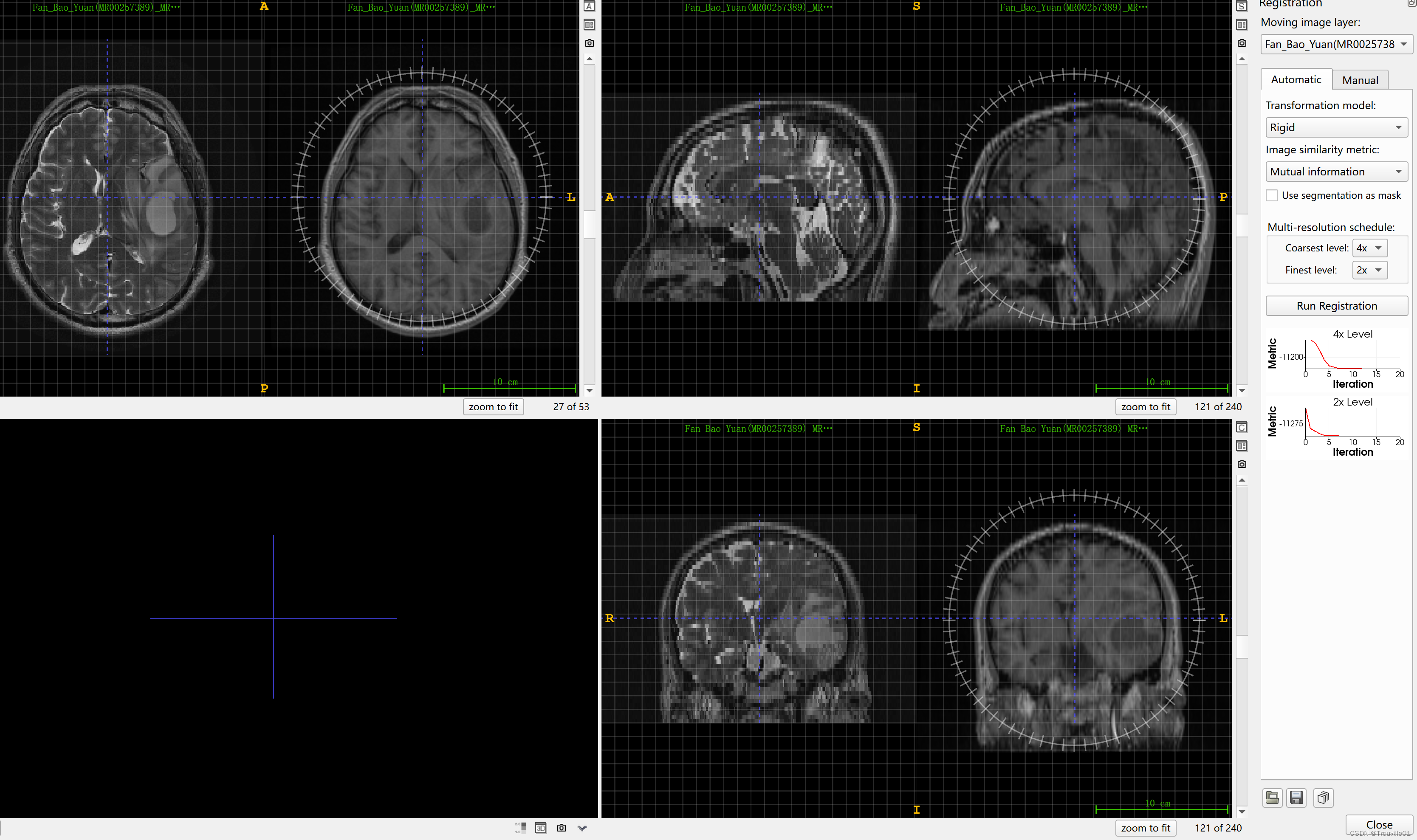 介绍一种医学影像配准的方法（使用itk-snap)_itksnap使用教程-CSDN博客