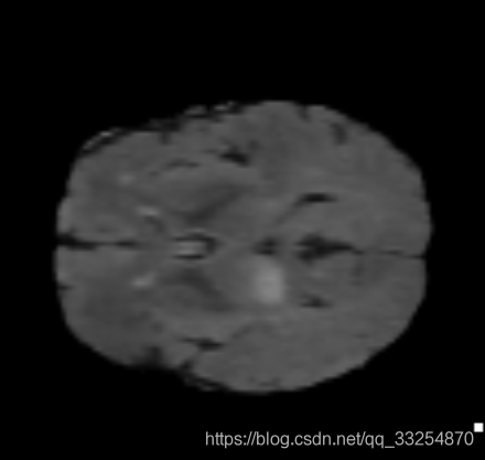 How to read the NIFTI format image (.nii file) - Programmer Sought