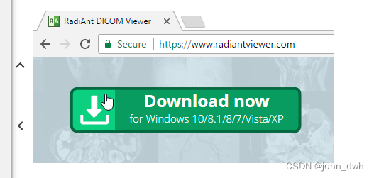RadiAnt DICOM Viewer 2022.1 Crack-CSDN博客