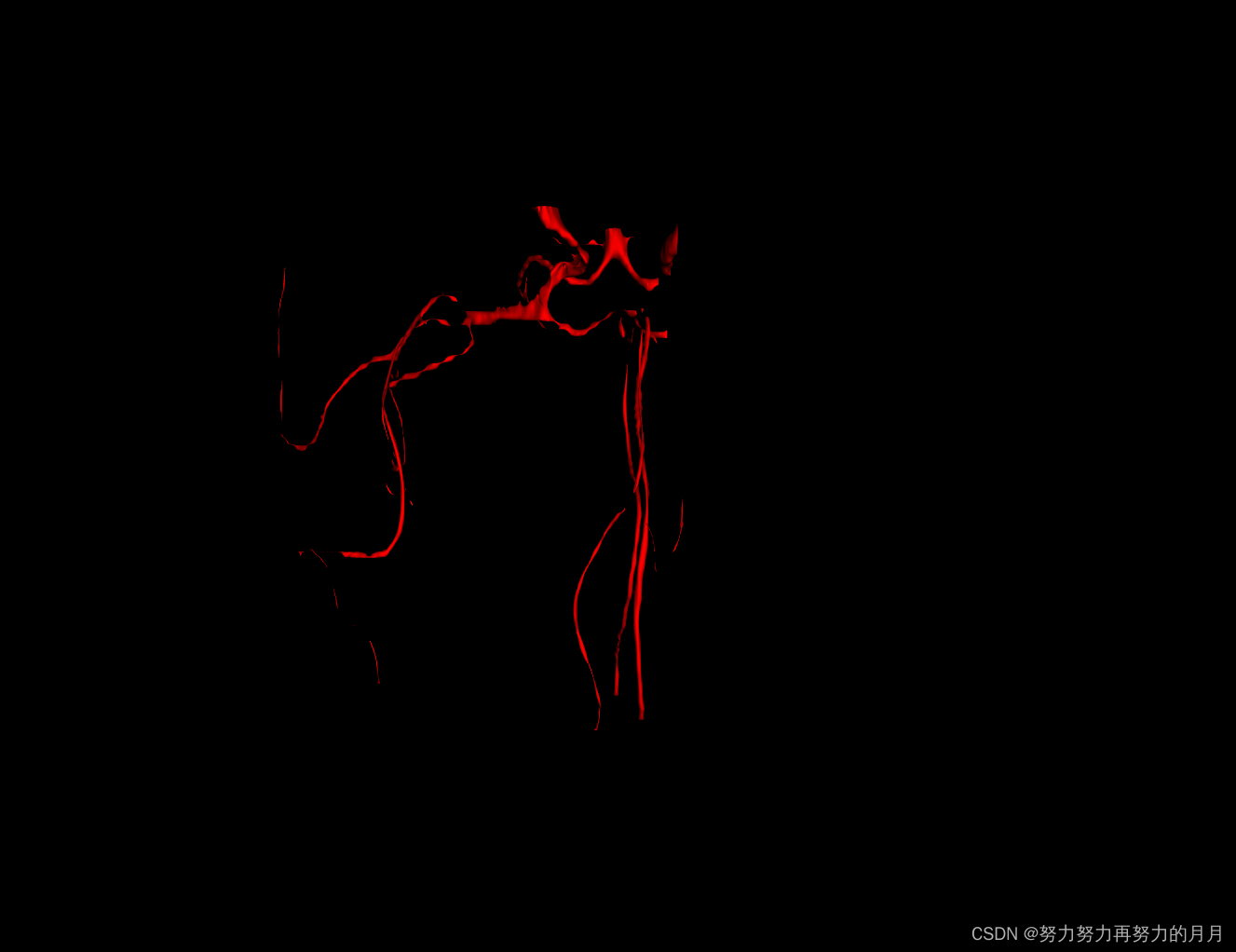 VTK显示三维NII的医学图像数据--等值面法_vtk nii-CSDN博客