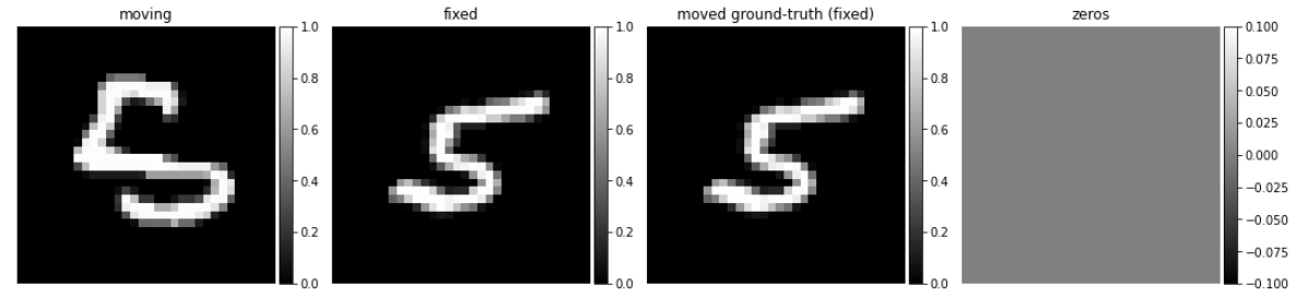 VoxelMorph-无监督医学图像配准-代码讲解-CSDN博客