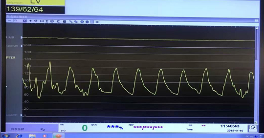 静态心电设备的数据采集（aECG）_java心电数据转换成hl7aecg xml文件-CSDN博客