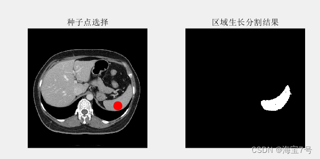 【第 26 章 基于最小误差法和区域生长的医学影响分割系统 Matlab深度学习实战gui项目】基于matlab Gui的医用系统开发 Csdn博客