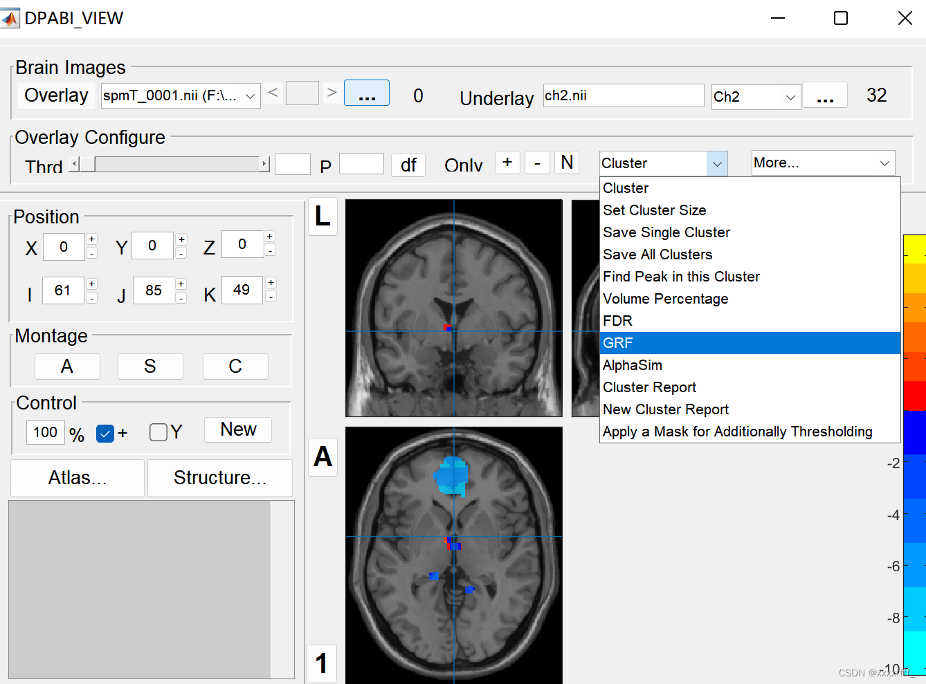dpabi viewer使用-CSDN博客
