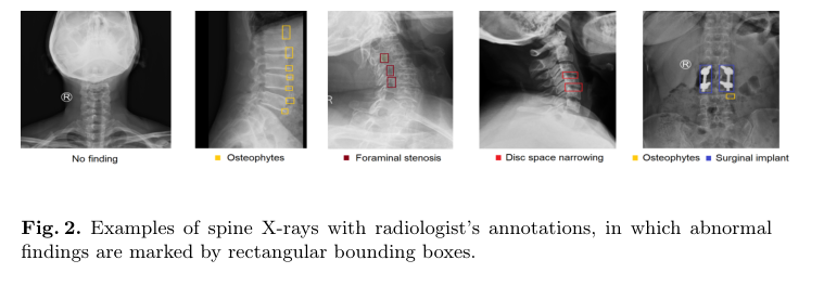 论文阅读：VinDr-SpineXR: A deep learning framework for spinal lesions detection and classification ...