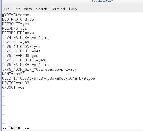 Linux: Solve Xshell link error: Could not connect to '192.168.75.128:28' (port 22): Connection ...