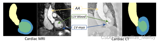 【论文笔记】PnP-AdaNet：即插即用的对抗域适应网络，用于跨模态心脏分割的基准_pnp 即插即用 深度学习-CSDN博客