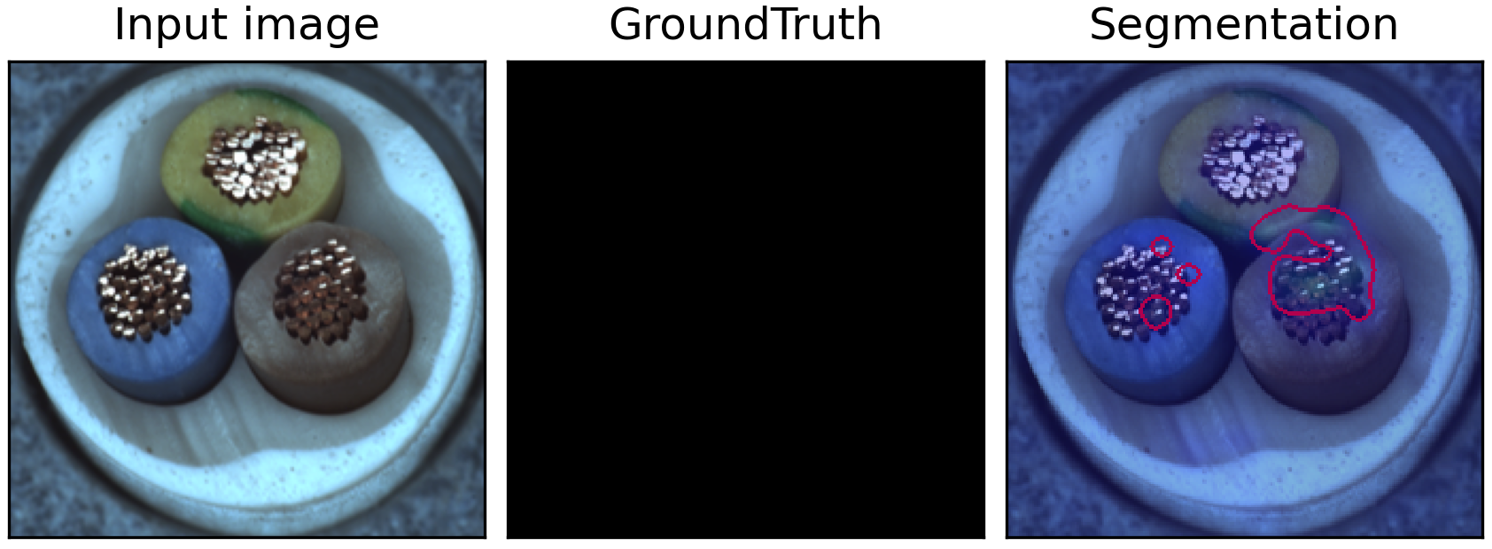 【阅读笔记】《Student-Teacher Feature Pyramid Matching for Anomaly Detection》_student-teacher feature ...
