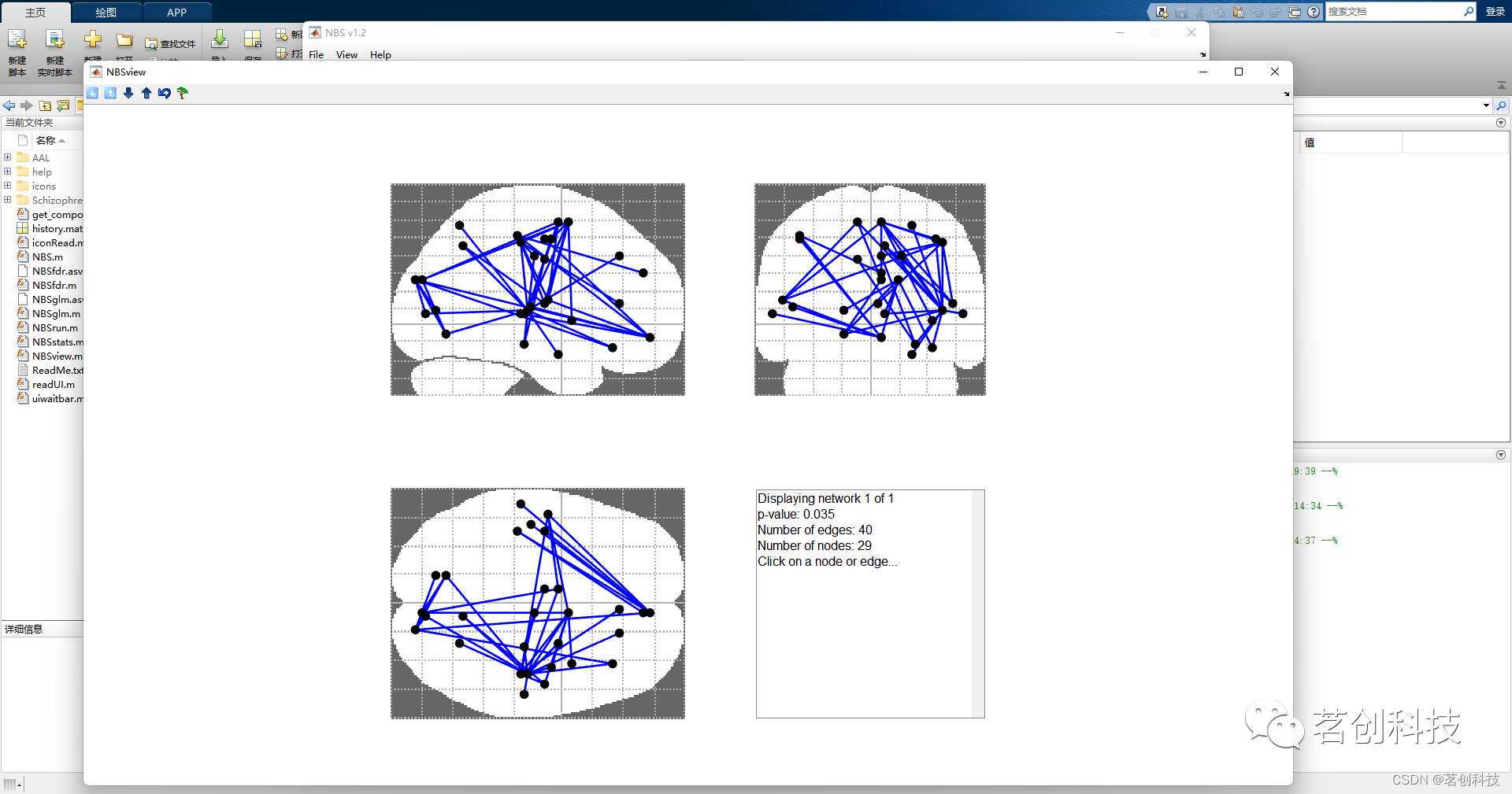 手把手教你使用NBS_mni坐标系定位脑区-CSDN博客