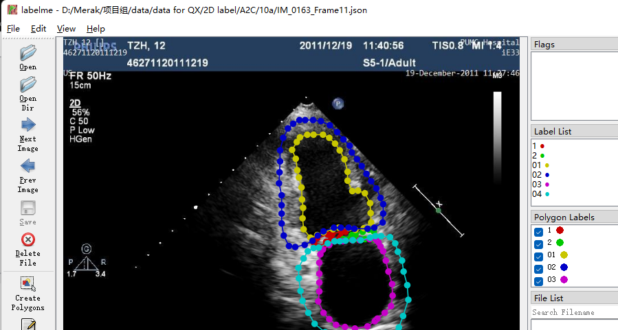 深度学习图像标注工具Lableme安装教程_labelme官网-CSDN博客