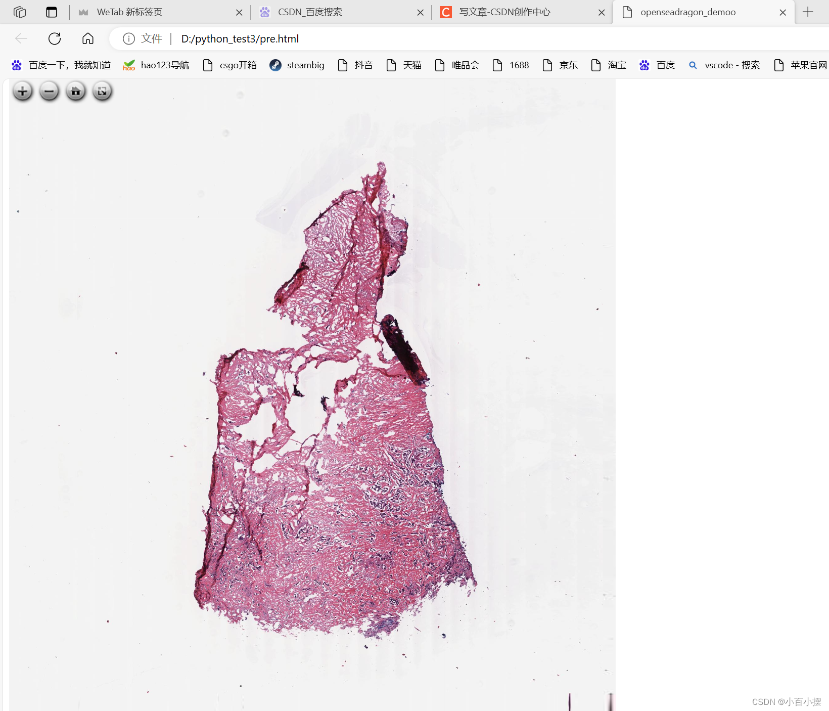 Python大作业 数字病理学图像svs文件任意倍率浏览-CSDN博客