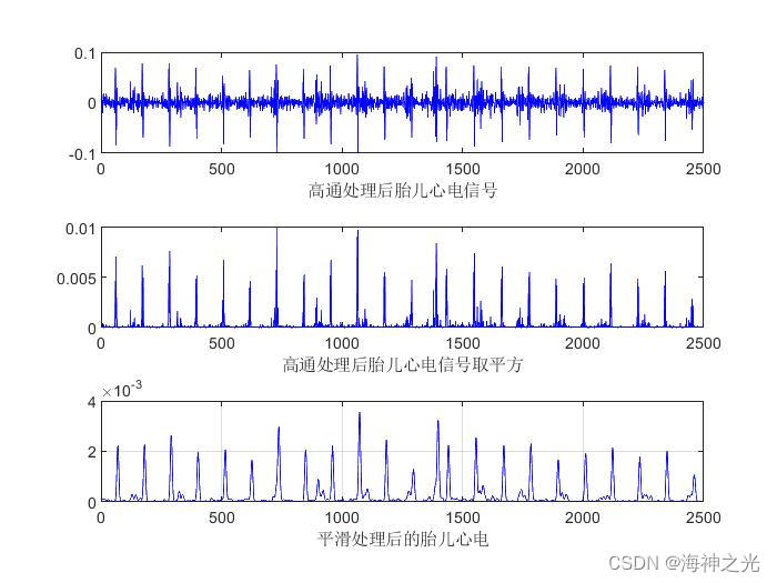 【心电信号ECG】基于matlab NLMS算法胎儿心电信号提取【含Matlab源码 3403期】_matlab lms算法 胎音信号-CSDN博客