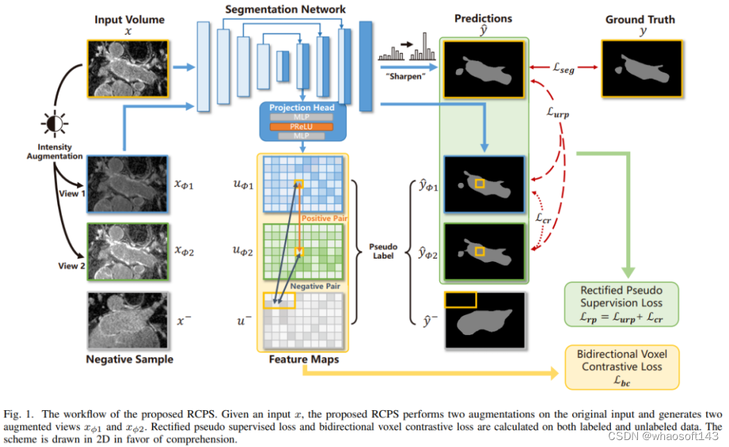 RCPS ~医学图像半监督分割_rcps: rectified contrastive pseudo supervision for-CSDN博客