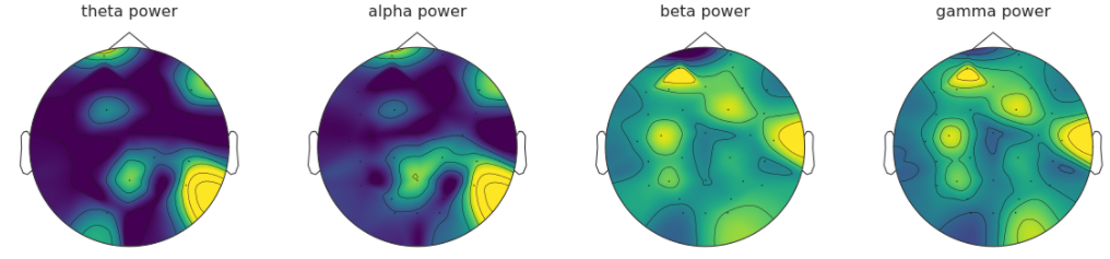 对deap数据集进行脑电情绪识别并进行频谱分析（频域特征）_对deap数据集进行脑电情绪识别并进行频谱分析(频域特征)-CSDN博客