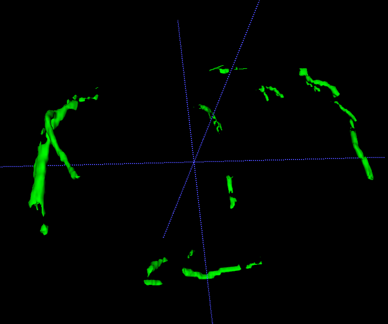 使用SimpleITK进行3D图像连通域分析_连通域分析后处理图-CSDN博客