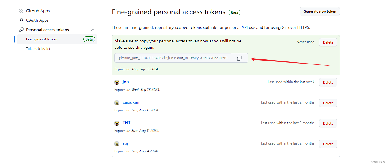 使用github Actions自动部署vue项目 Vue 项目怎么在github上配置actions Csdn博客