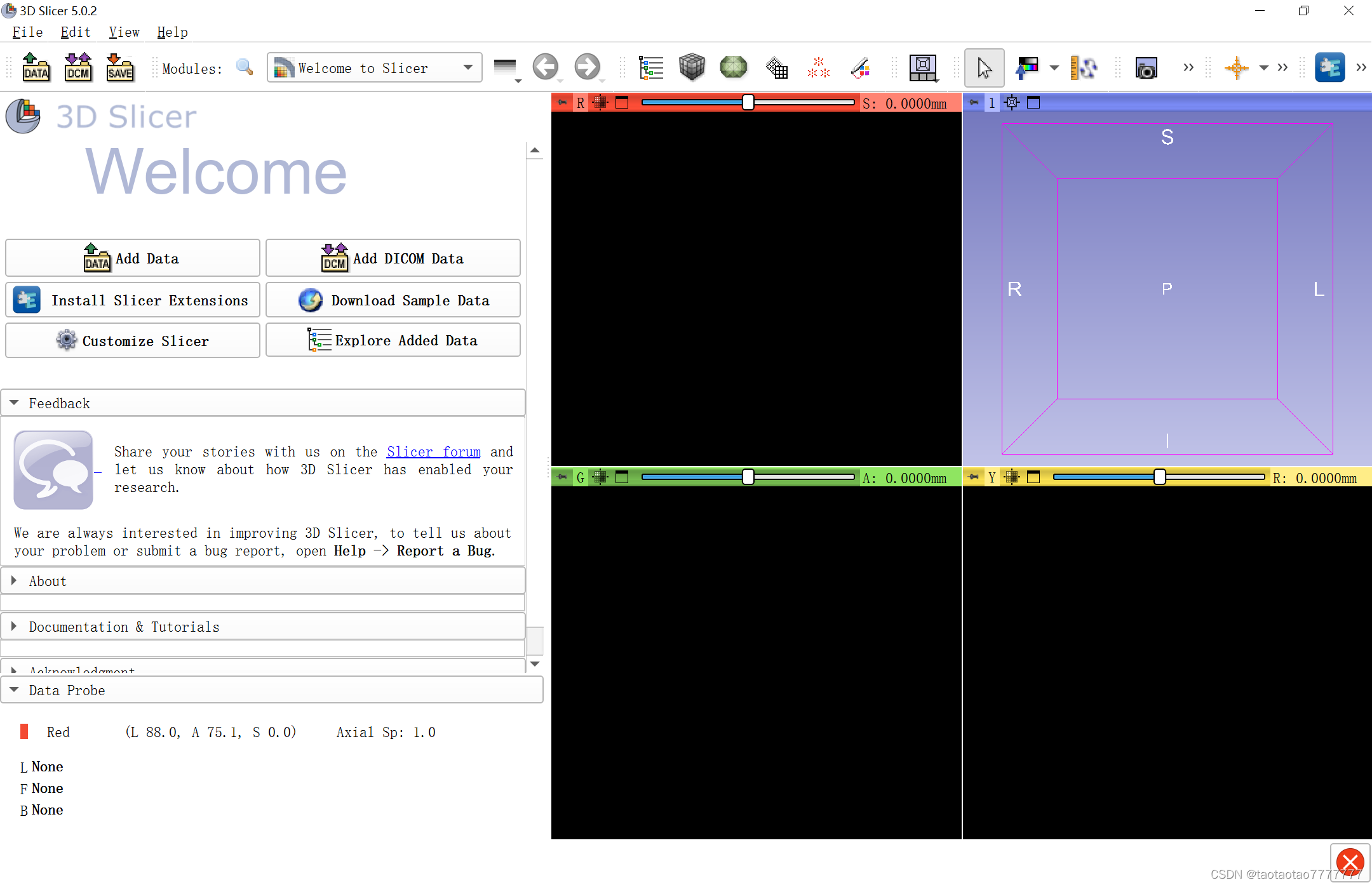 【影像组学】基于 atlas 感兴趣区提取 (3D slicer)_3dslicer 生成标准头模-CSDN博客